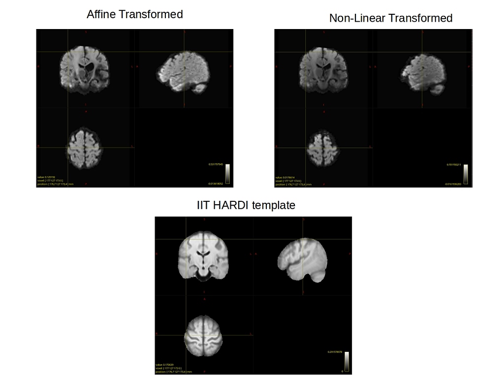 Mrregister and the IIT HARDI template - MRtrix3 Community