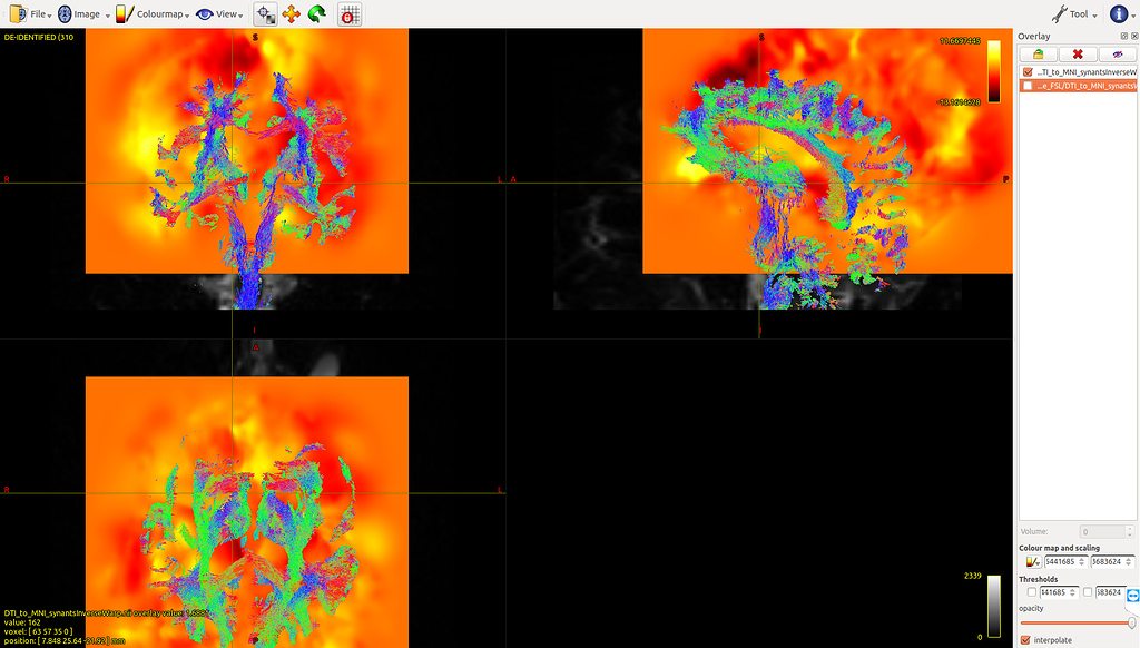 Image registration for diffusion MRI - MRtrix3 Community