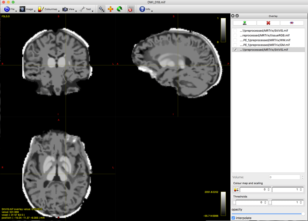 5ttgen output: vis file and quality control - MRtrix3 Community