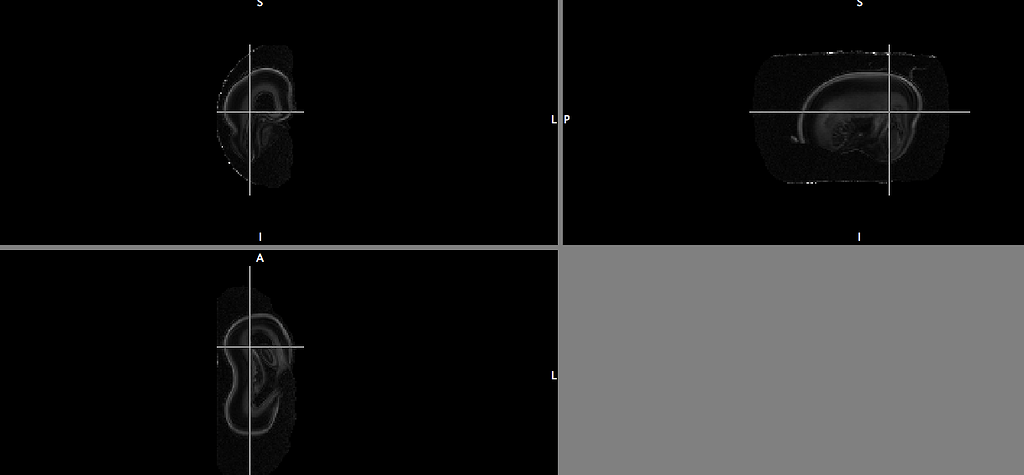 Which dwi2response algorithm will work best - MRtrix3 Community