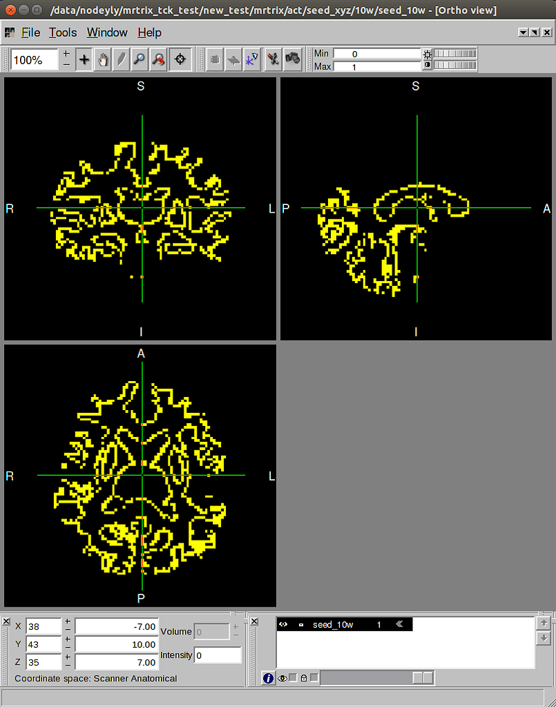 Gmwmi mask - MRtrix3 Community