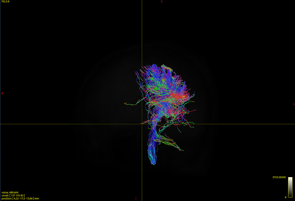 Strange error when using tcknormalise - tractography - MRtrix3 Community