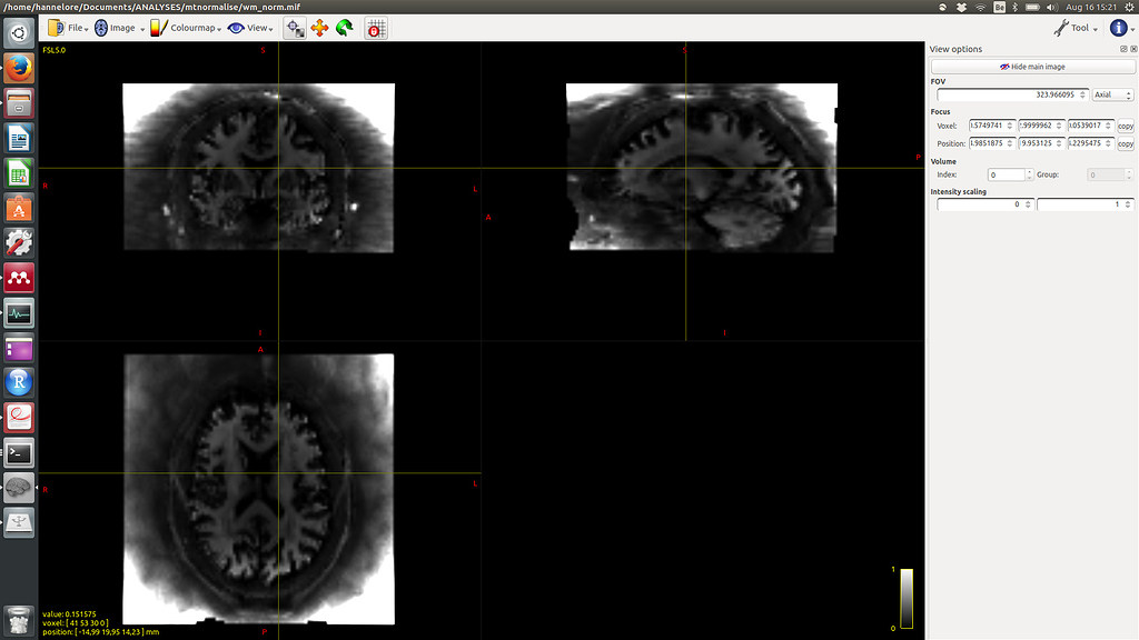 Mtnormalise as preparation for response function averaging - MRtrix3 Community