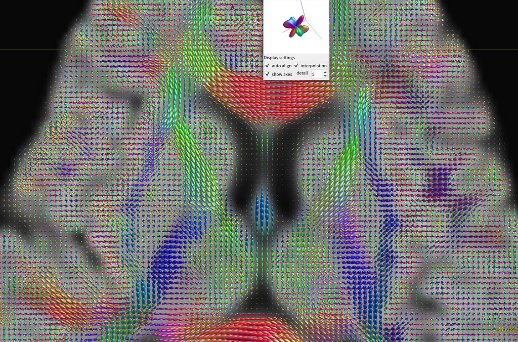 Questions about FOD abnormalities and bias correction in single-shell FBA pipeline - MRtrix3 ...