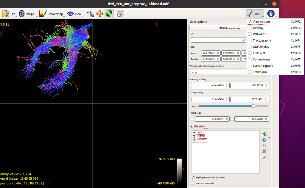 Volume Render - MRtrix3 Community