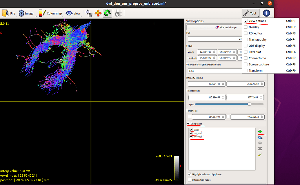 Volume Render - MRtrix3 Community