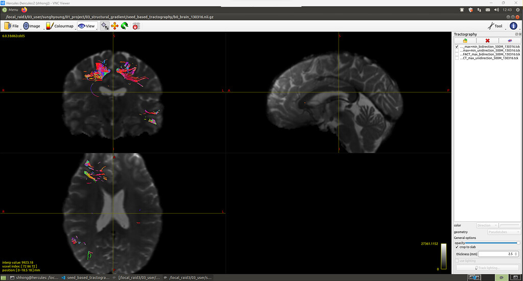 Seed-based tractography - tractography - MRtrix3 Community