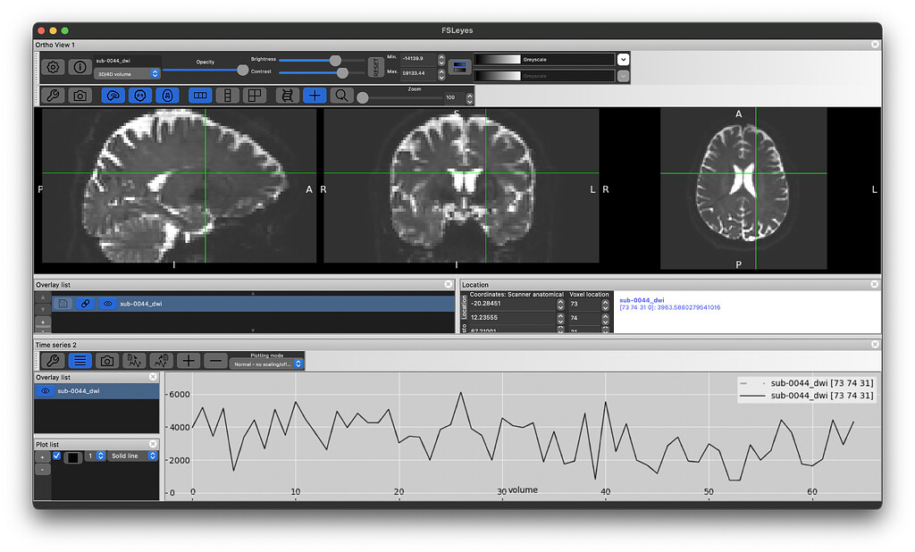 b0 volumes with high intensity than b1000 - MRtrix3 Community