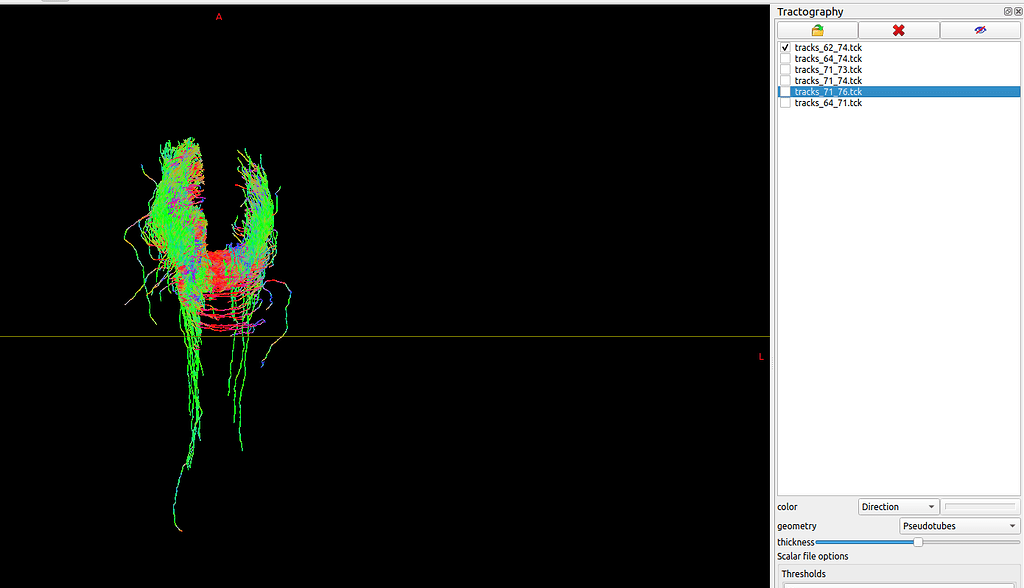 Erroneous L streamlines for R RACG to MOFG tracts - MRtrix3 Community