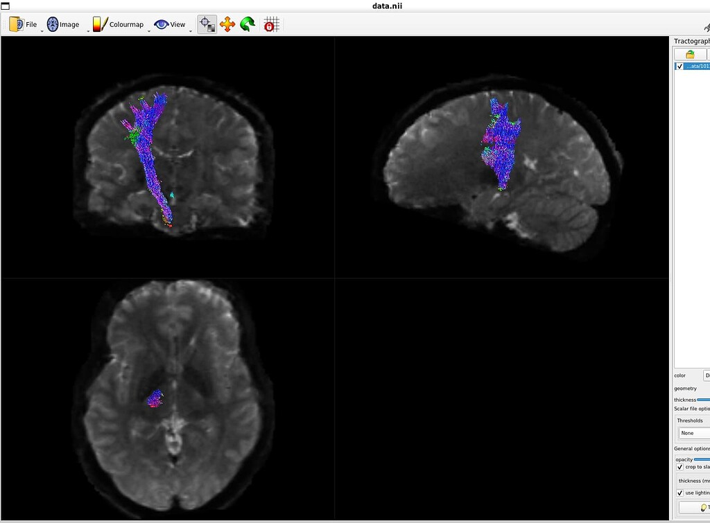 Windows 11 - MRtrix3 works natively on WSLg - MRtrix3 Community