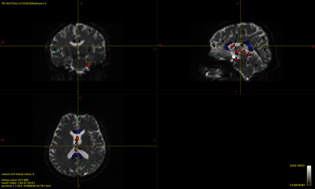 dwi2response output: voxels.mif - MRtrix3 Community