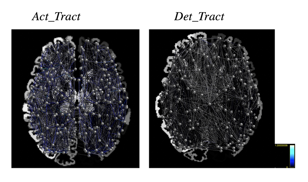 Multi-shell DTI Connectiivty - MRtrix3 Community