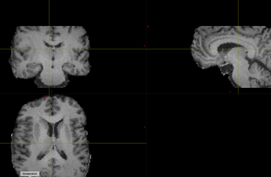 Transforming 5TT image to different space - MRtrix3 Community