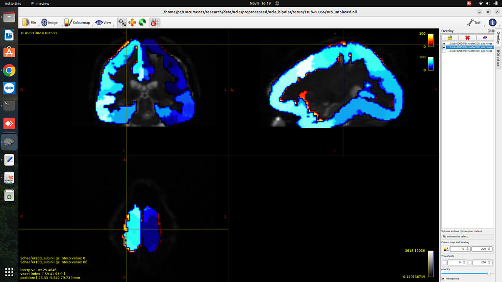 Poor registration issue - preprocessing - MRtrix3 Community