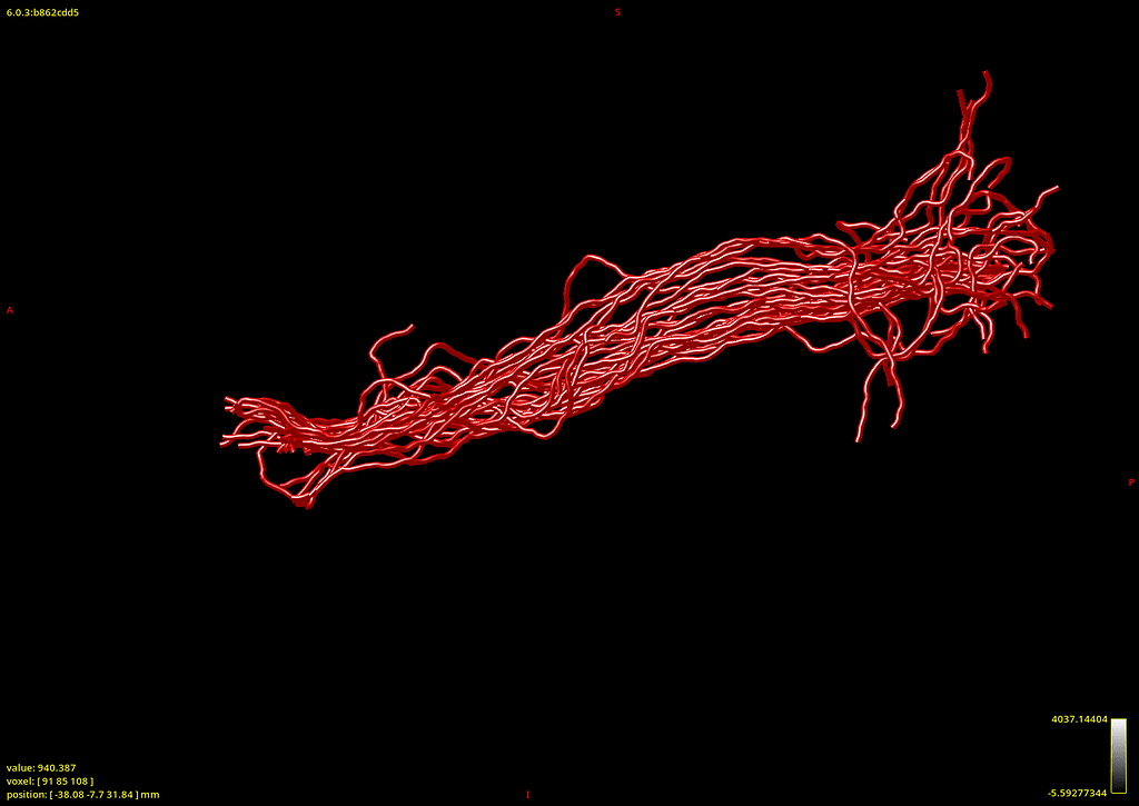 Smoothed tracts for poster - tractography - MRtrix3 Community