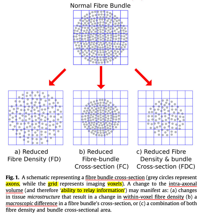 Interpretation the fixel-based metrics in a scenario of reduced FD without FC changes - fba ...