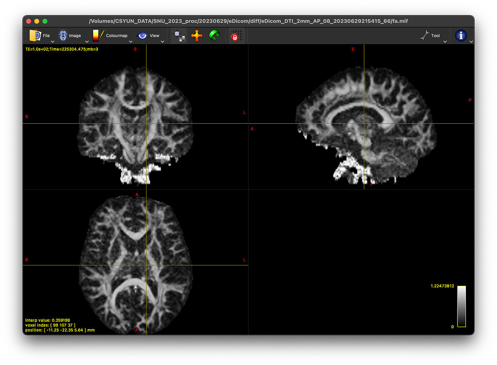 Calculate FA map using multishell data - preprocessing - MRtrix3 Community