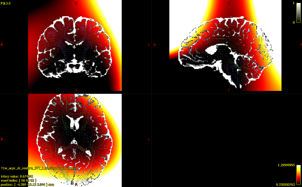 Mtnormalise results on HCP data - preprocessing - MRtrix3 Community