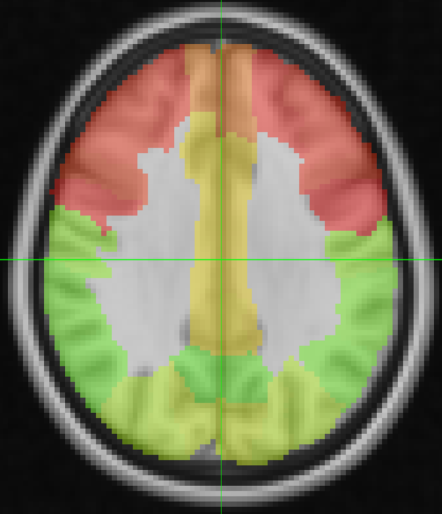 Mismatch between AAL template and MNI152 - MRtrix3 Community