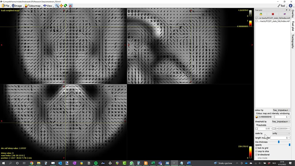 Finding the fissure calcarine on neonate DTI imaging - MRtrix3 Community
