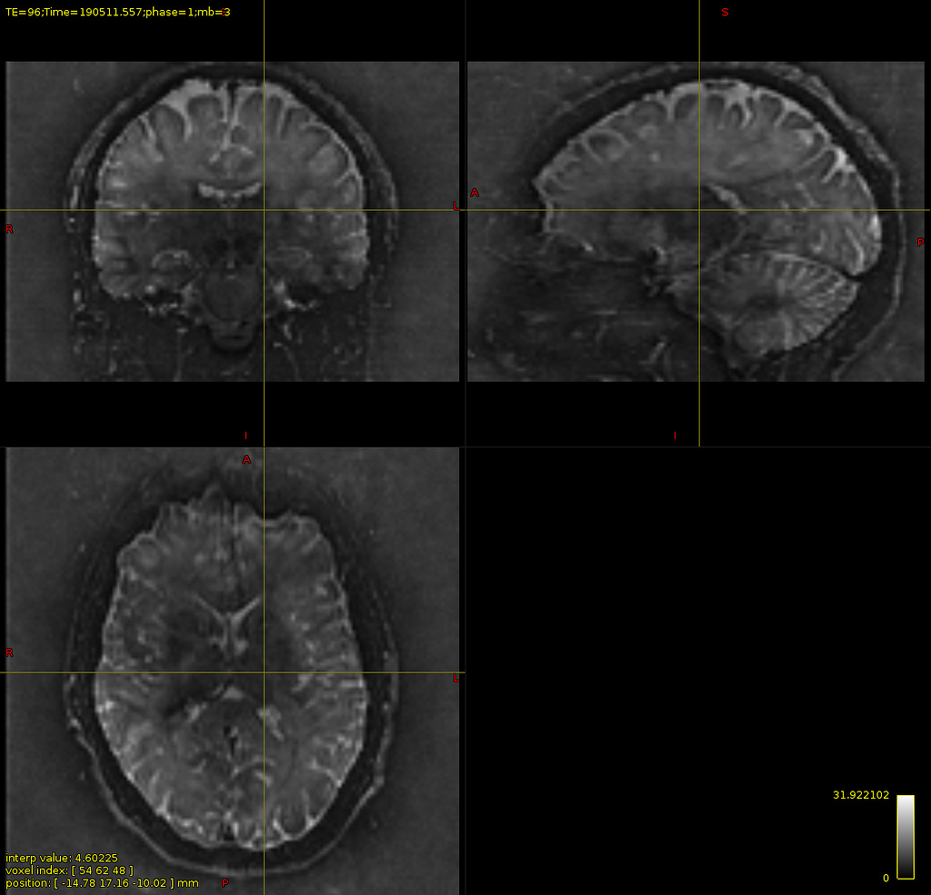 Data quality check - MRtrix3 Community