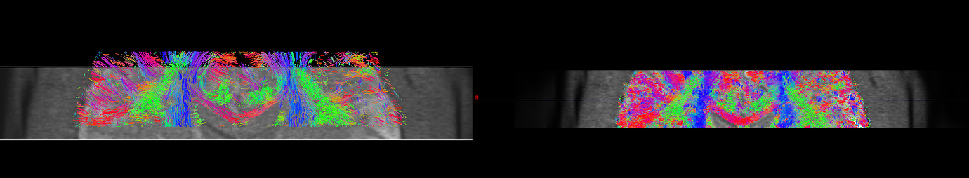 Conversion of streamlines from trk to tck - tractography - MRtrix3 Community