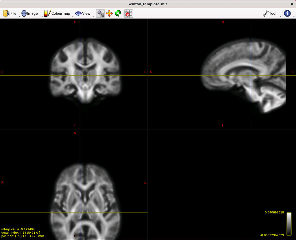 Population template FOV cropped issue - error - MRtrix3 Community