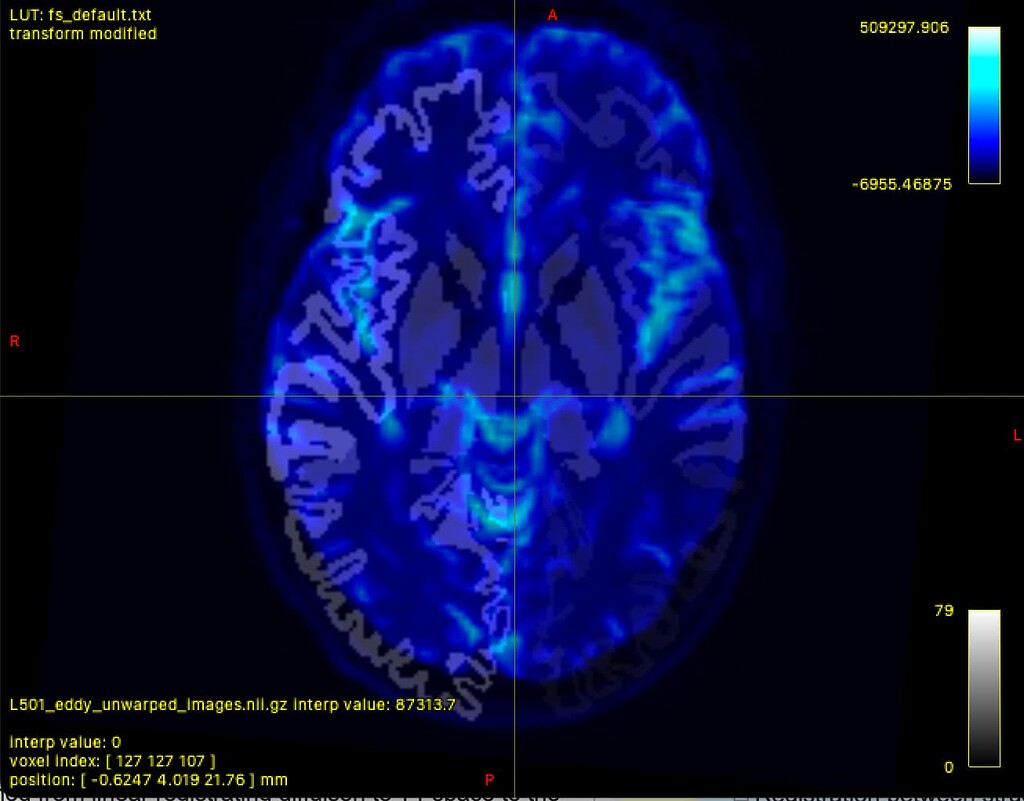 Coregistrtaion of Freesurfer output and diffusion image - MRtrix3 Community