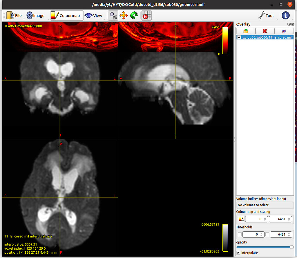 ERROR when coregister the T1w to the diffusion image - preprocessing - MRtrix3 Community