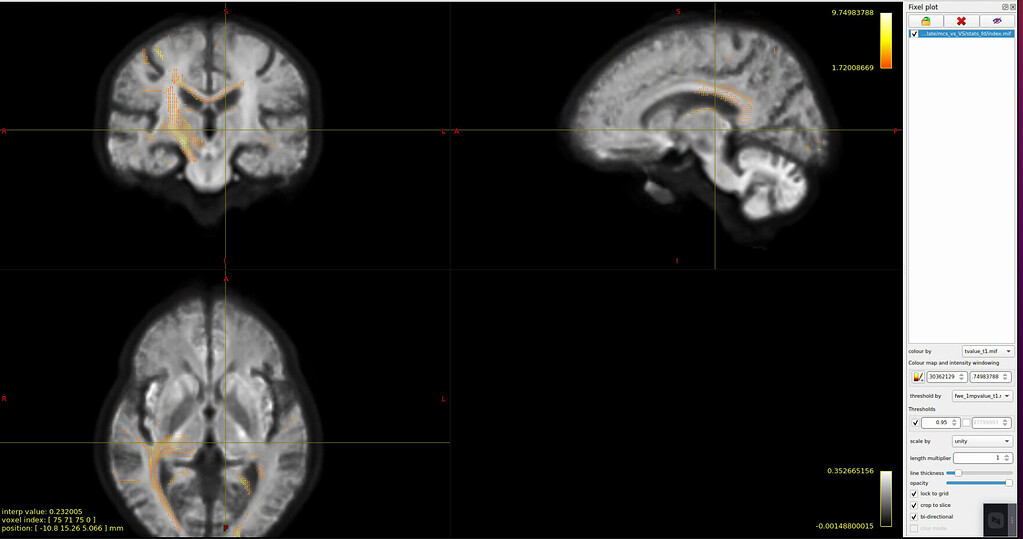 Problems about explaining fixelcfestats results - MRtrix3 Community