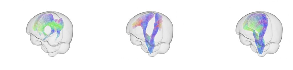 How to visualize fibers like this figure - tractography - MRtrix3 Community