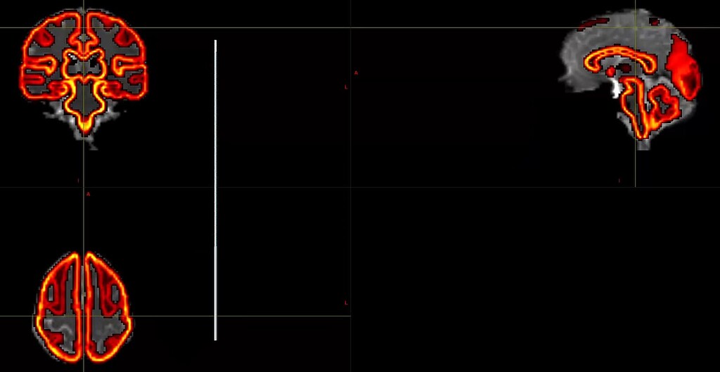 5ttgen processing T2w images - tractography - MRtrix3 Community