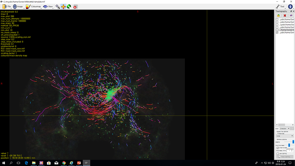Im a beginner trying to trace fibres - MRtrix3 Community