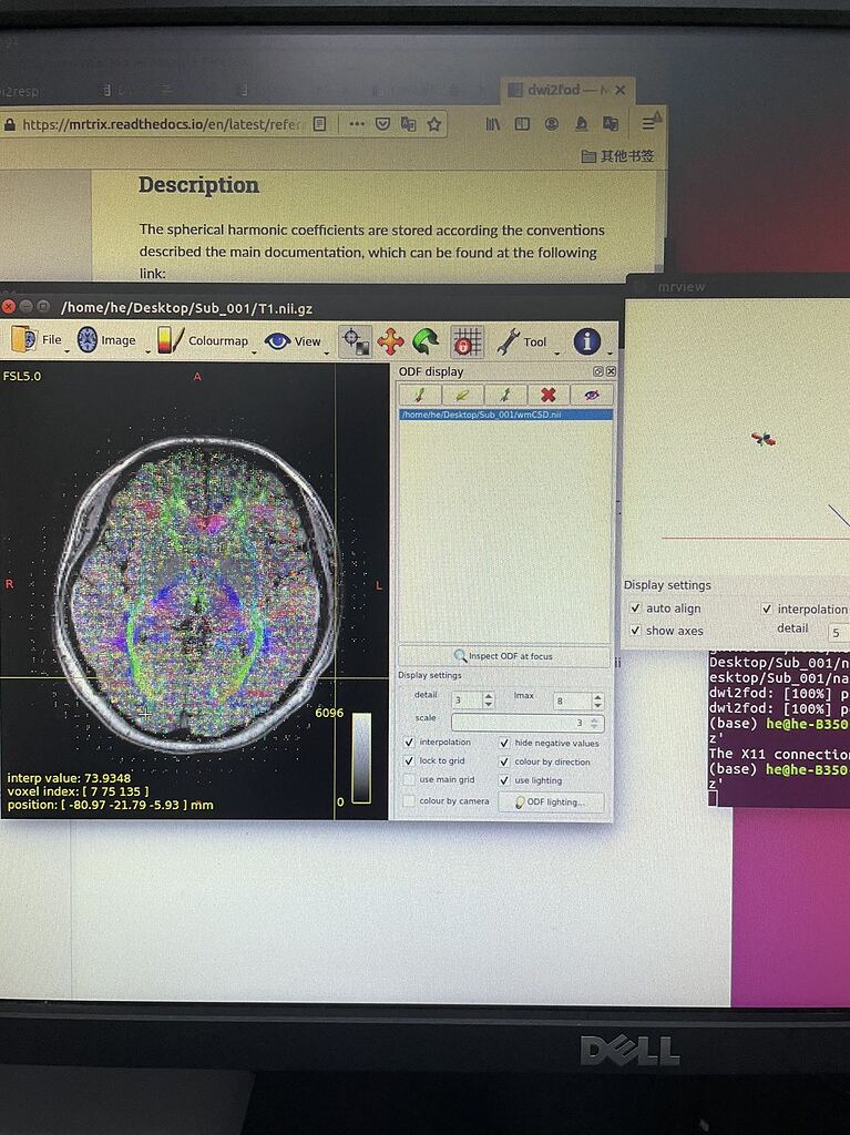 wmFOD overflow T1 - MRtrix3 Community