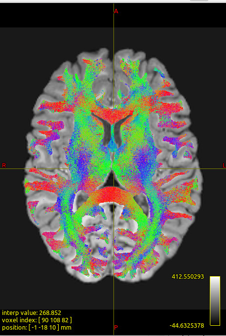 Whole-brain tck to MNI - tractography - MRtrix3 Community