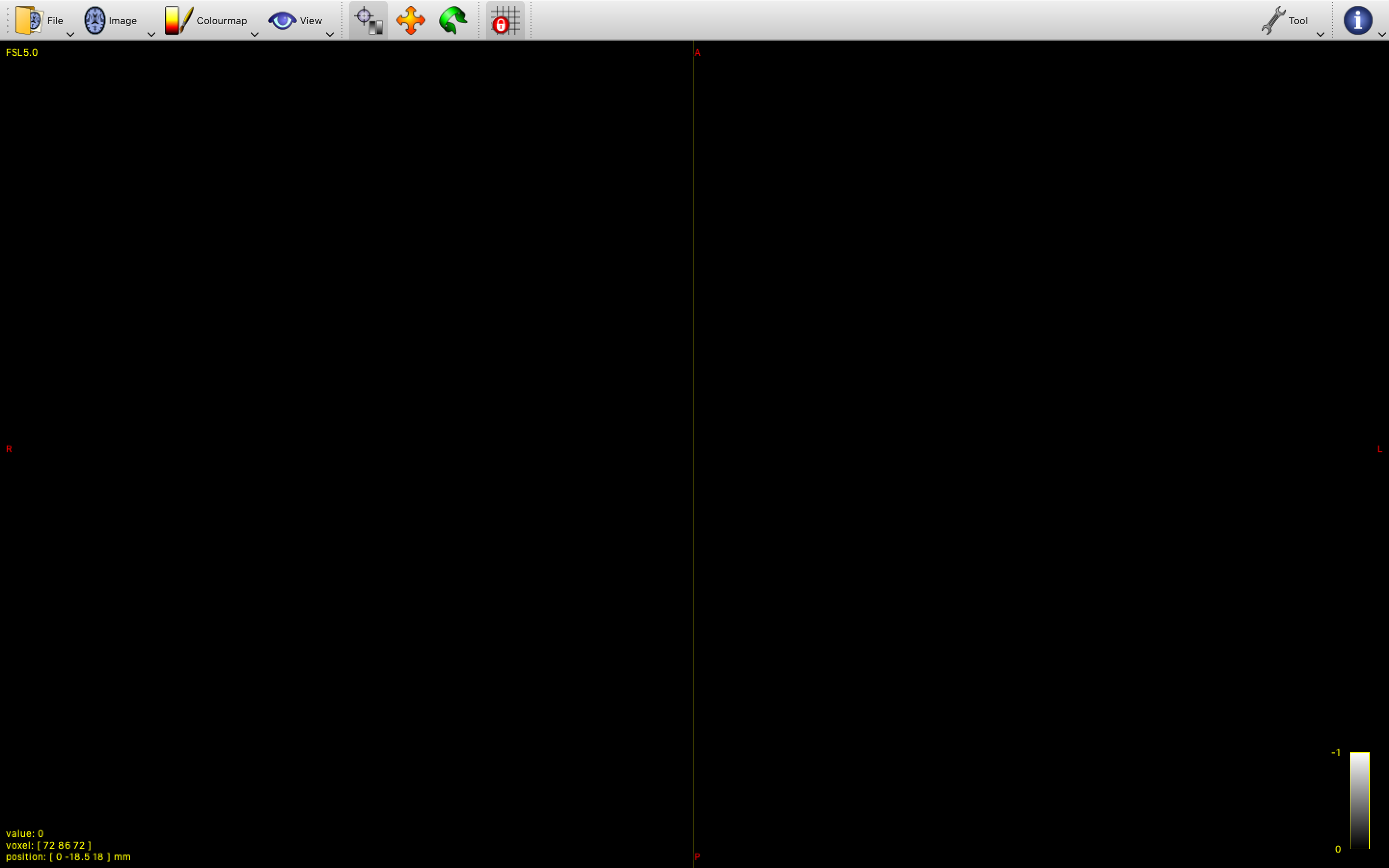 Error with dwi2response - MRtrix3 Community