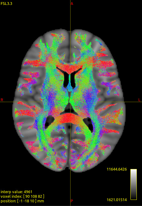 Whole-brain tck to MNI - tractography - MRtrix3 Community